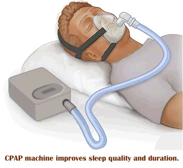More Sleep Apnea in African Americans - Dr. Greg Hall