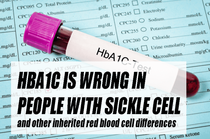HbA1c Diabetes Test is Inaccurate in African Americans